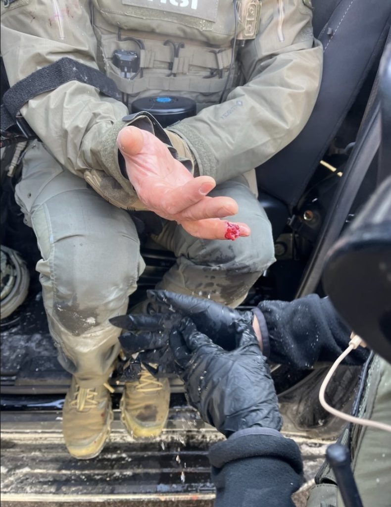 Rioter bites officer's finger off in Minneapolis during violent unrest ...