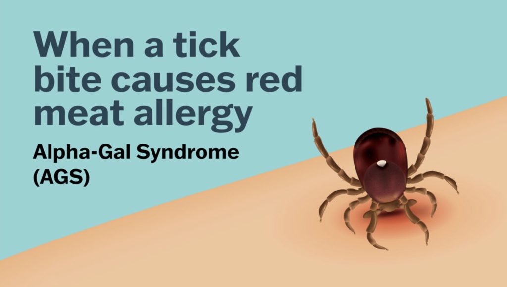 Linda Boyle: Ticks that can make you allergic to red meat - a vegan’s ...